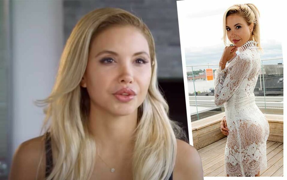 Elena Belle öppnar Upp Om Sina Skönhetsingrepp Hänt