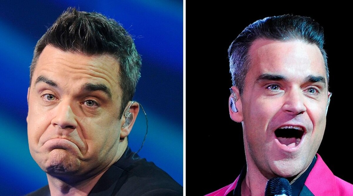 Robbie Williams - från babyfejs till botox och fillers | Hänt