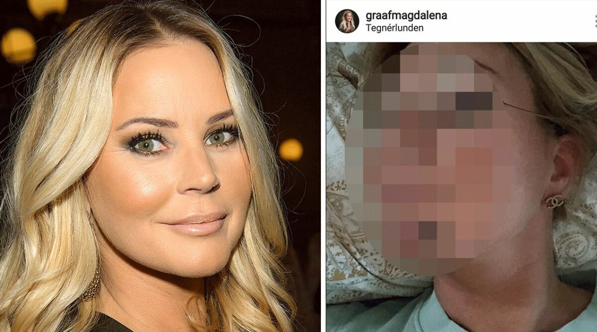 Graafs skräckskada efter Lego-incidenten: "Ingen vacker syn" | Hänt