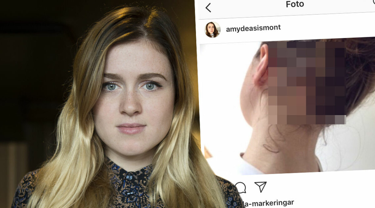 Amy Diamond ärliga ord om sjukdomen: "Jag grät" | Hänt