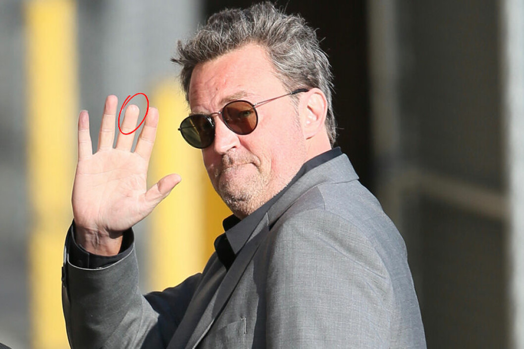 Här är stjärnorna med udda kroppsdelar | Hänt