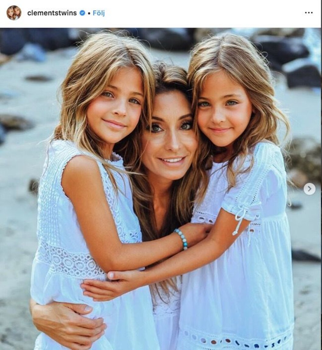 7 år senare – så ser världens vackraste tvillingar ut idag | Hänt